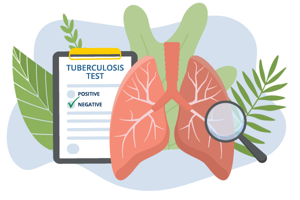 Tuberculosis (TB) Infection Testing and Treatments - Concentra