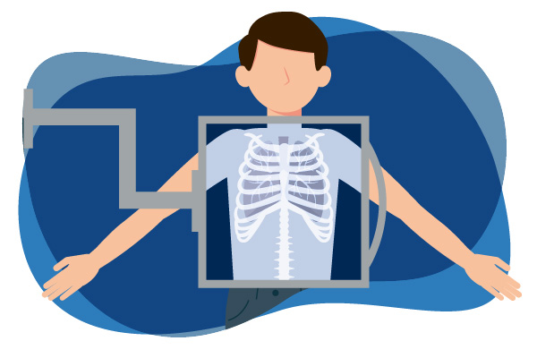 Tuberculosis (TB) Infection Testing and Treatments - Concentra