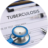 Choosing the Right TB Test - Concentra